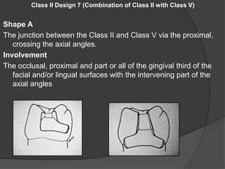 Modifications of Class 2 Cavity preparations | PPTX