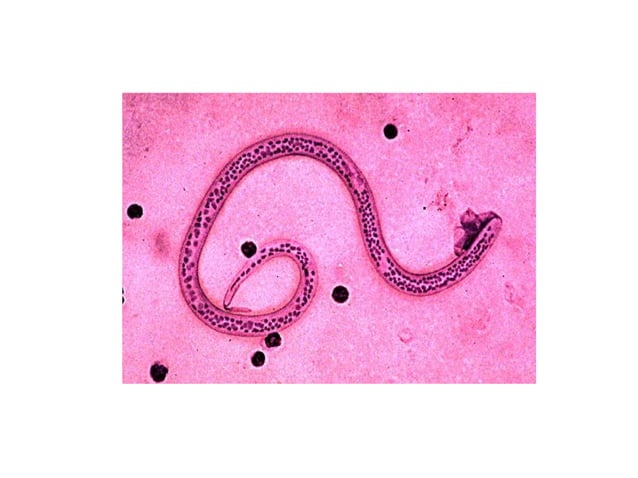 HELMINTHIASIS HELMINTHIC INFECTION | PPT