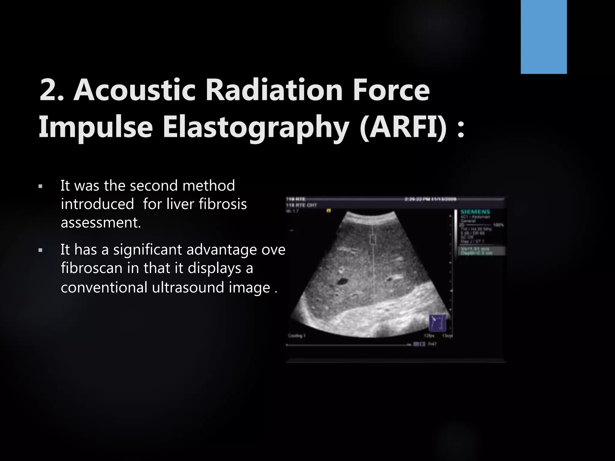 shear wave liver elastography.pptx