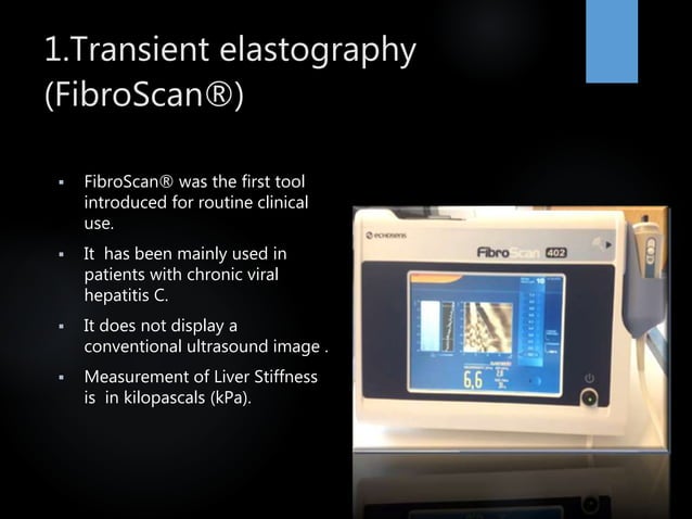 shear wave liver elastography.pptx