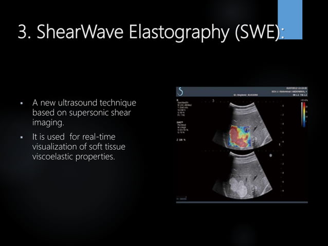 shear wave liver elastography.pptx
