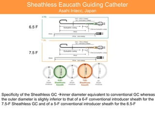 Tessitore E - AIMRADIAL 2014 - Sheathless | PPT