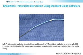 Louvard Y - AIMRADIAL 2014 - Sheathless | PPTX