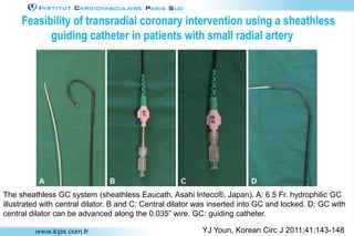 Louvard Y - AIMRADIAL 2014 - Sheathless | PPTX