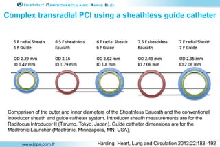 Louvard Y - AIMRADIAL 2014 - Sheathless | PPTX