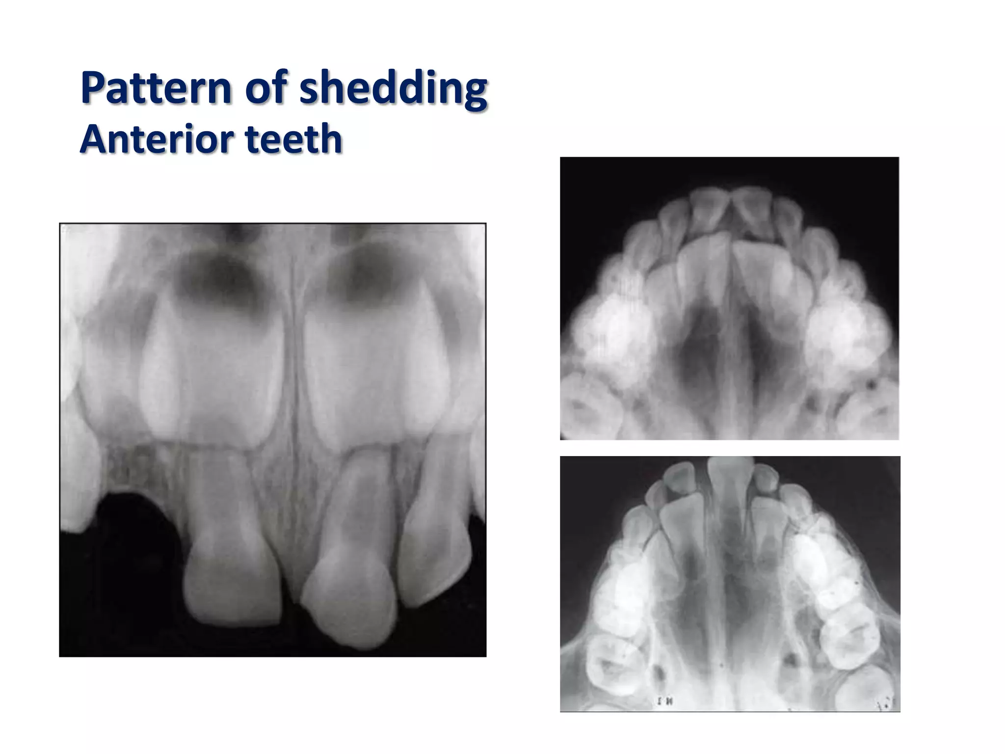 Shedding | PPTX