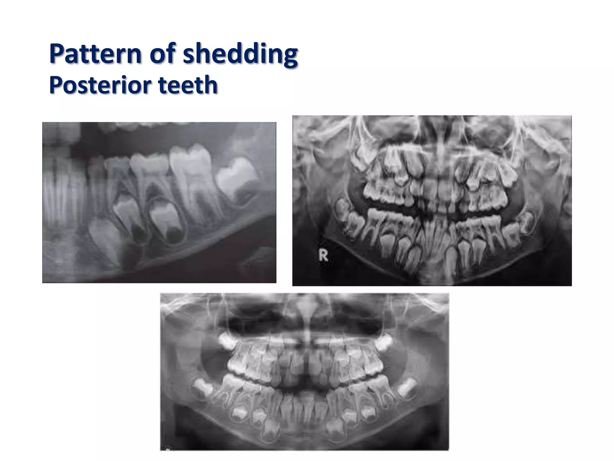 Shedding | PPTX