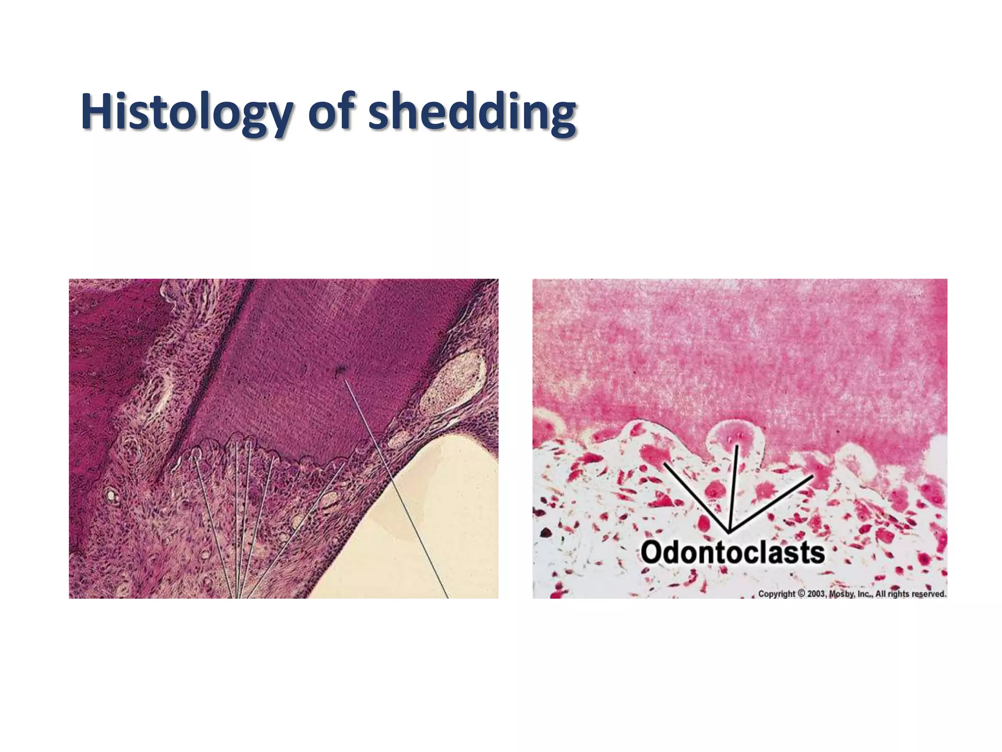 Shedding | PPTX