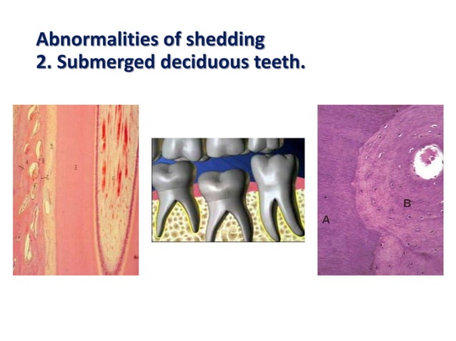 Shedding | PPTX