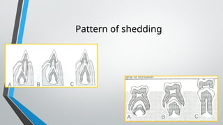SHEDDING OF TEETH - INTRODUCTION AND HISTOLOGY | PPTX