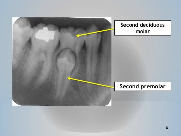 Shedding of deciduous teeth.