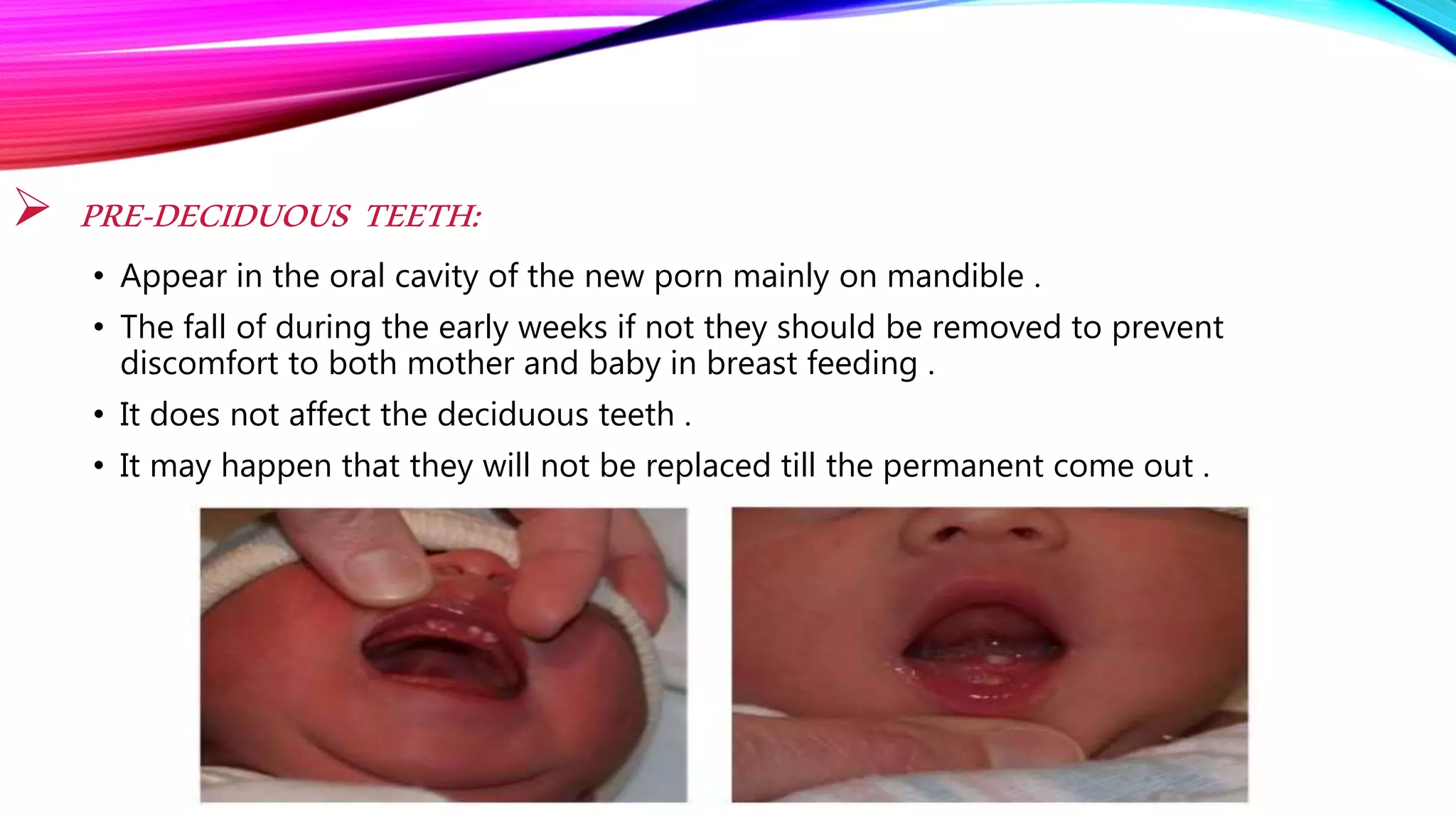 Shedding of the deciduous teeth | PPTX