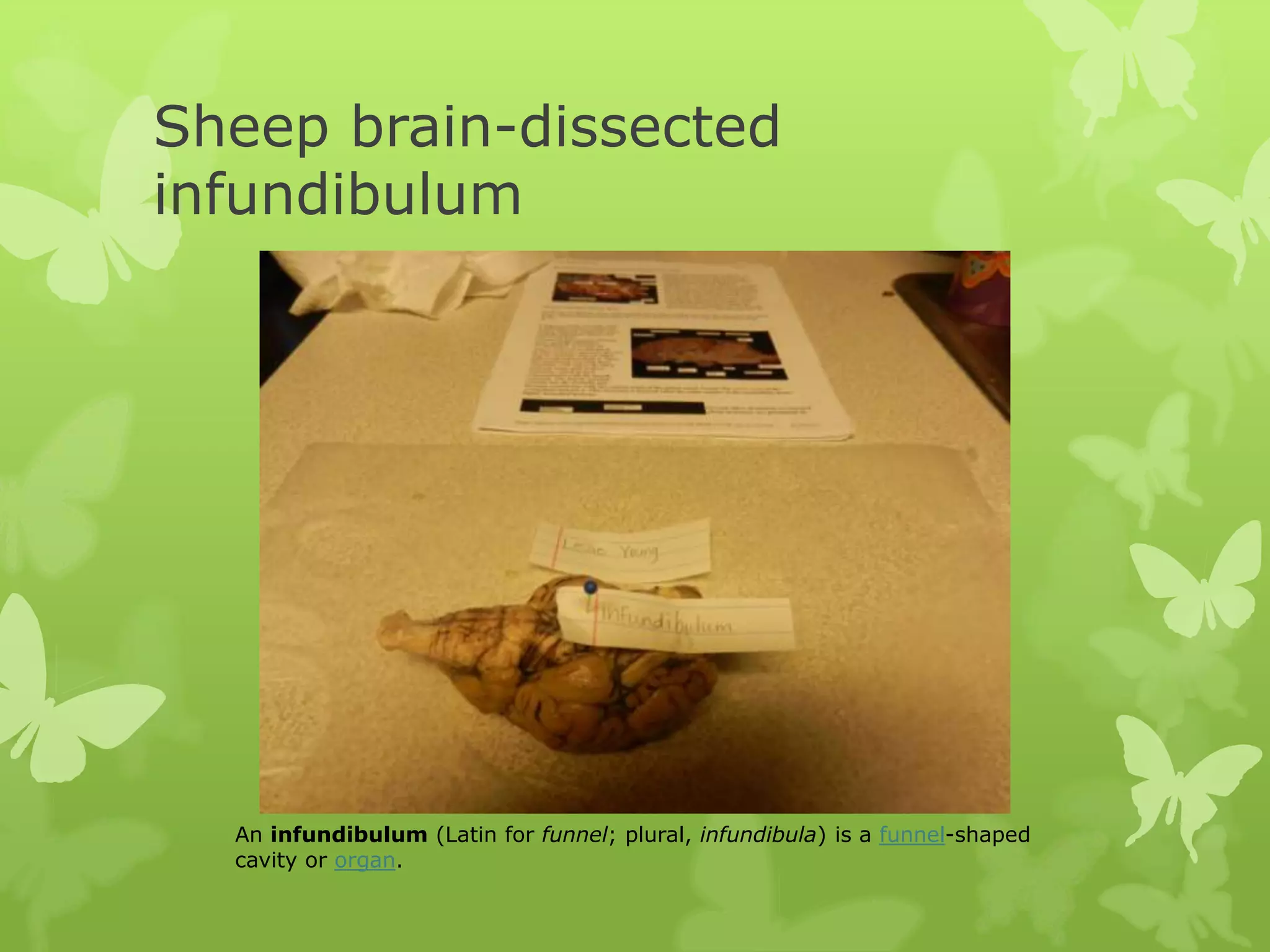 Sheep brain dissection and label | PPTX