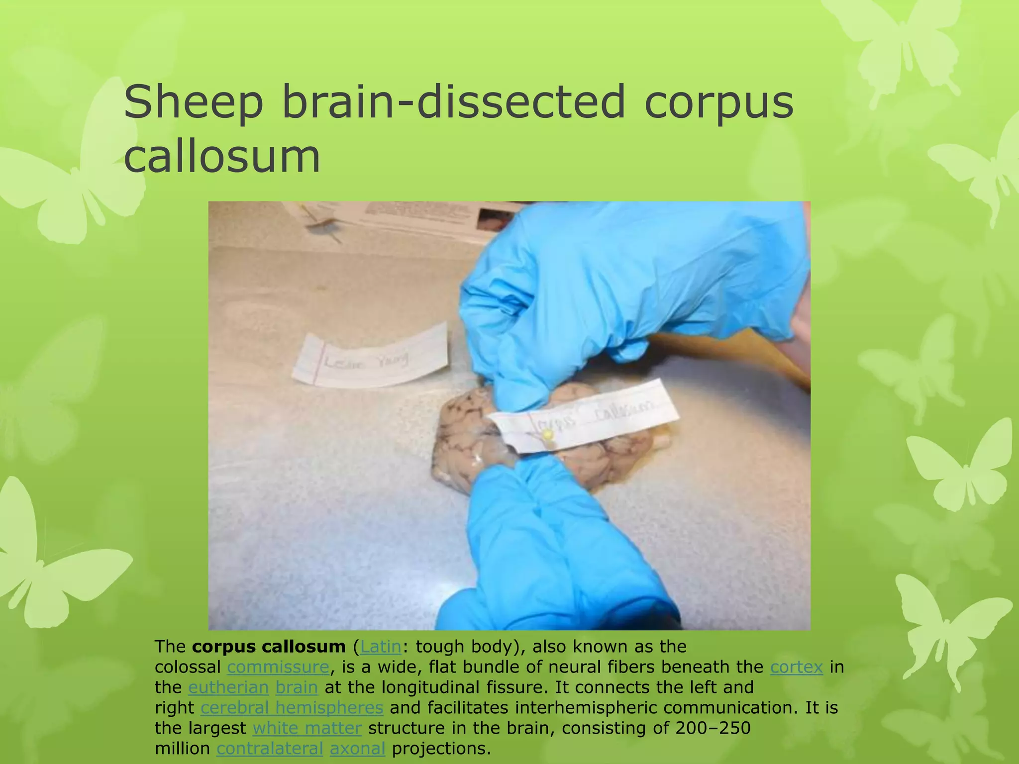 Sheep brain dissection and label | PPTX
