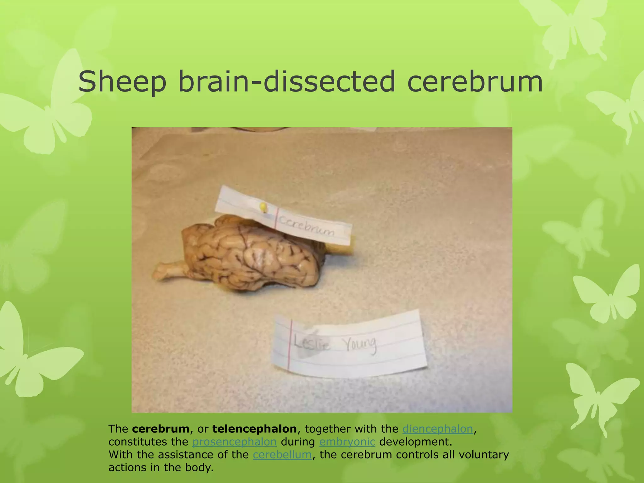 Sheep brain dissection and label | PPTX