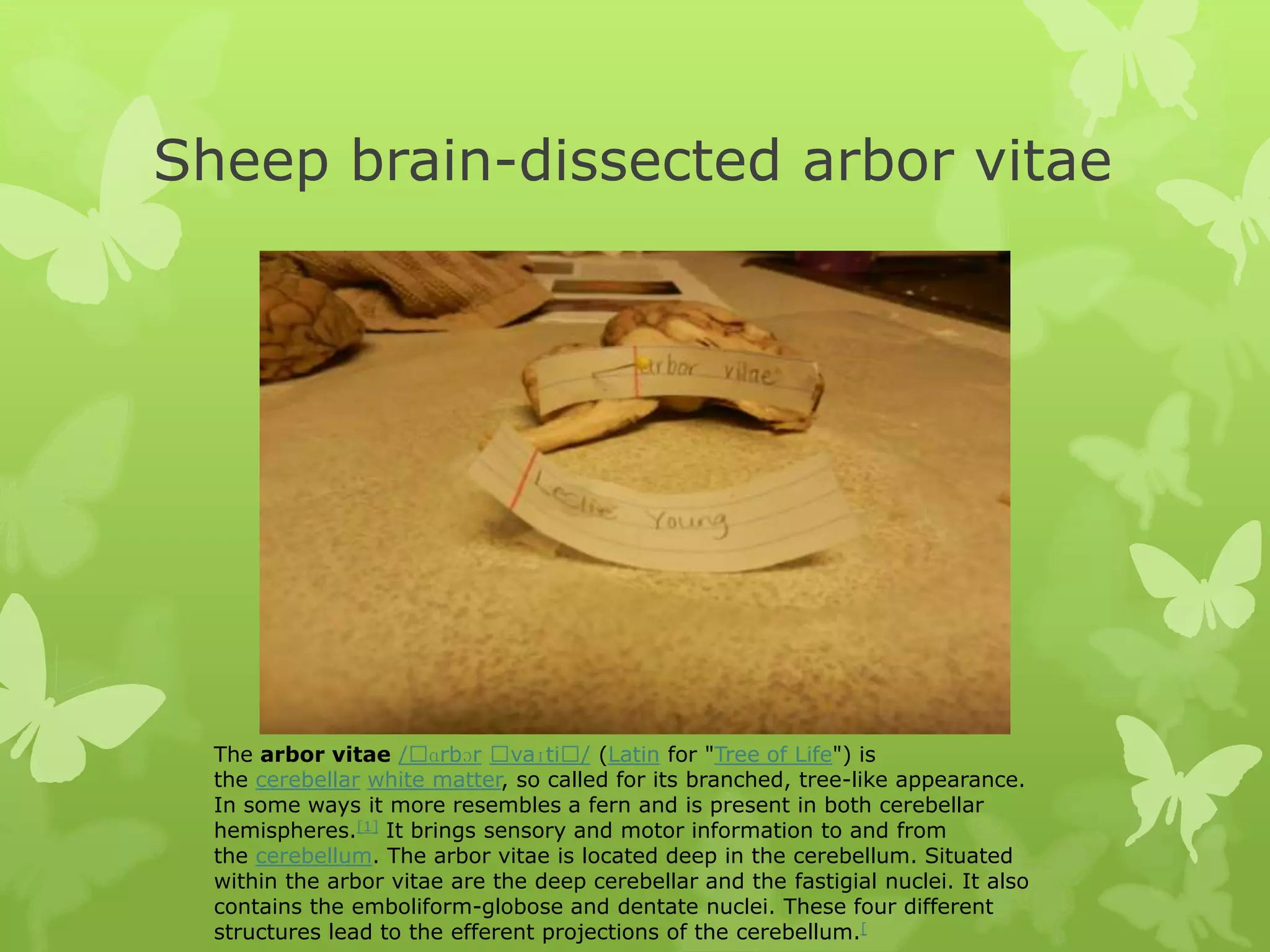 Sheep brain dissection and label | PPTX