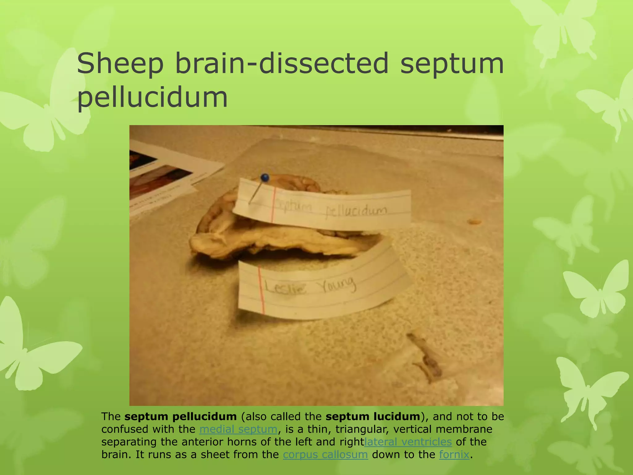 Sheep brain dissection and label | PPTX