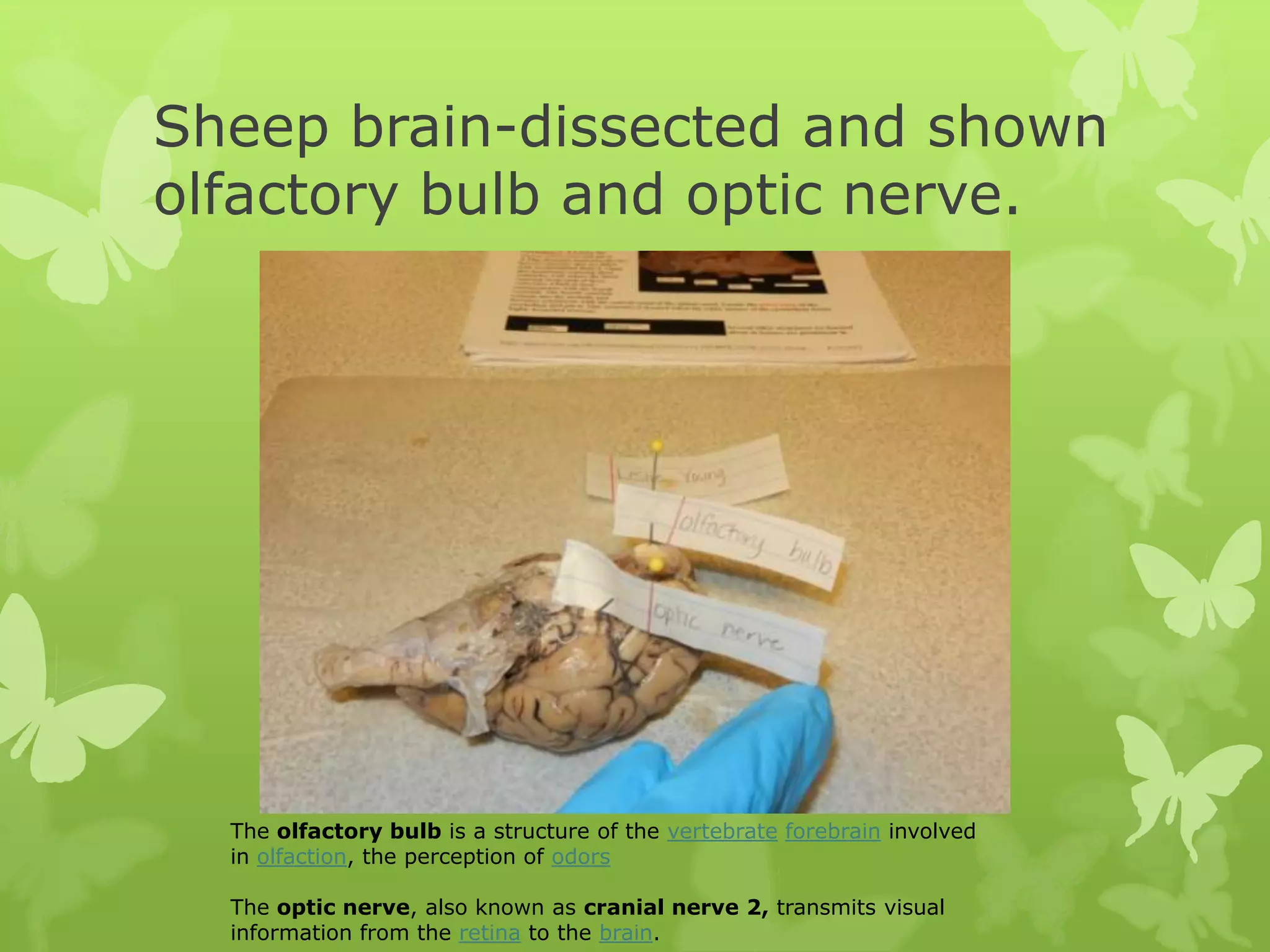 Sheep brain dissection and label | PPTX