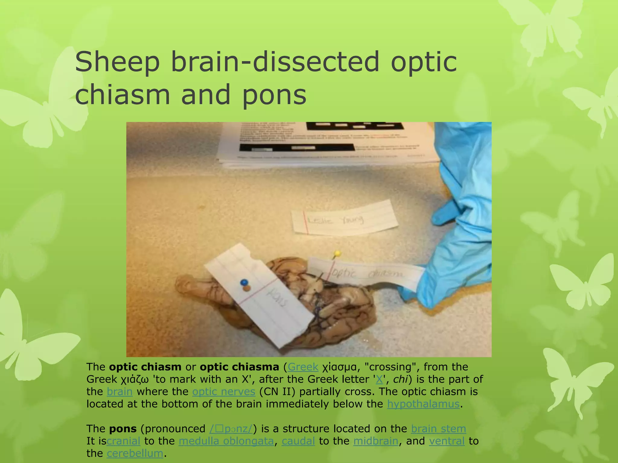 Sheep brain dissection and label | PPTX