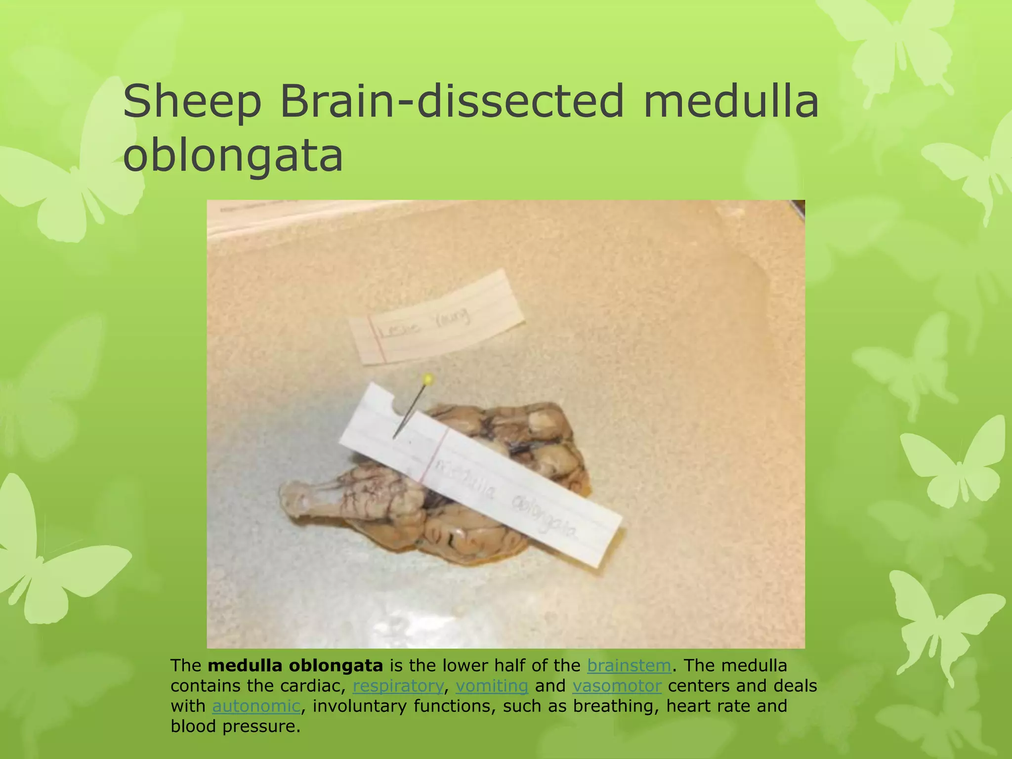 Sheep brain dissection and label | PPTX