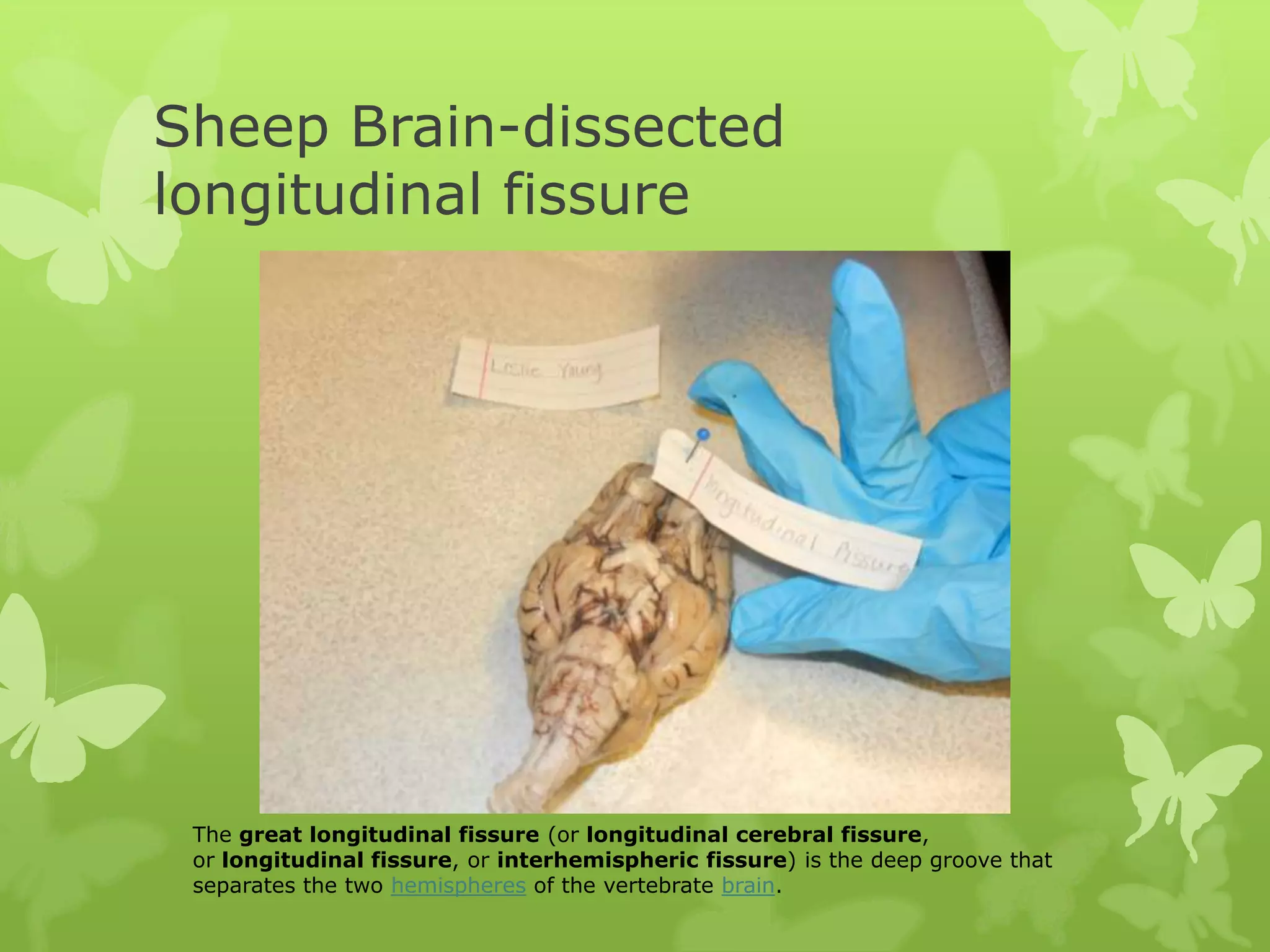 Sheep brain dissection and label | PPTX