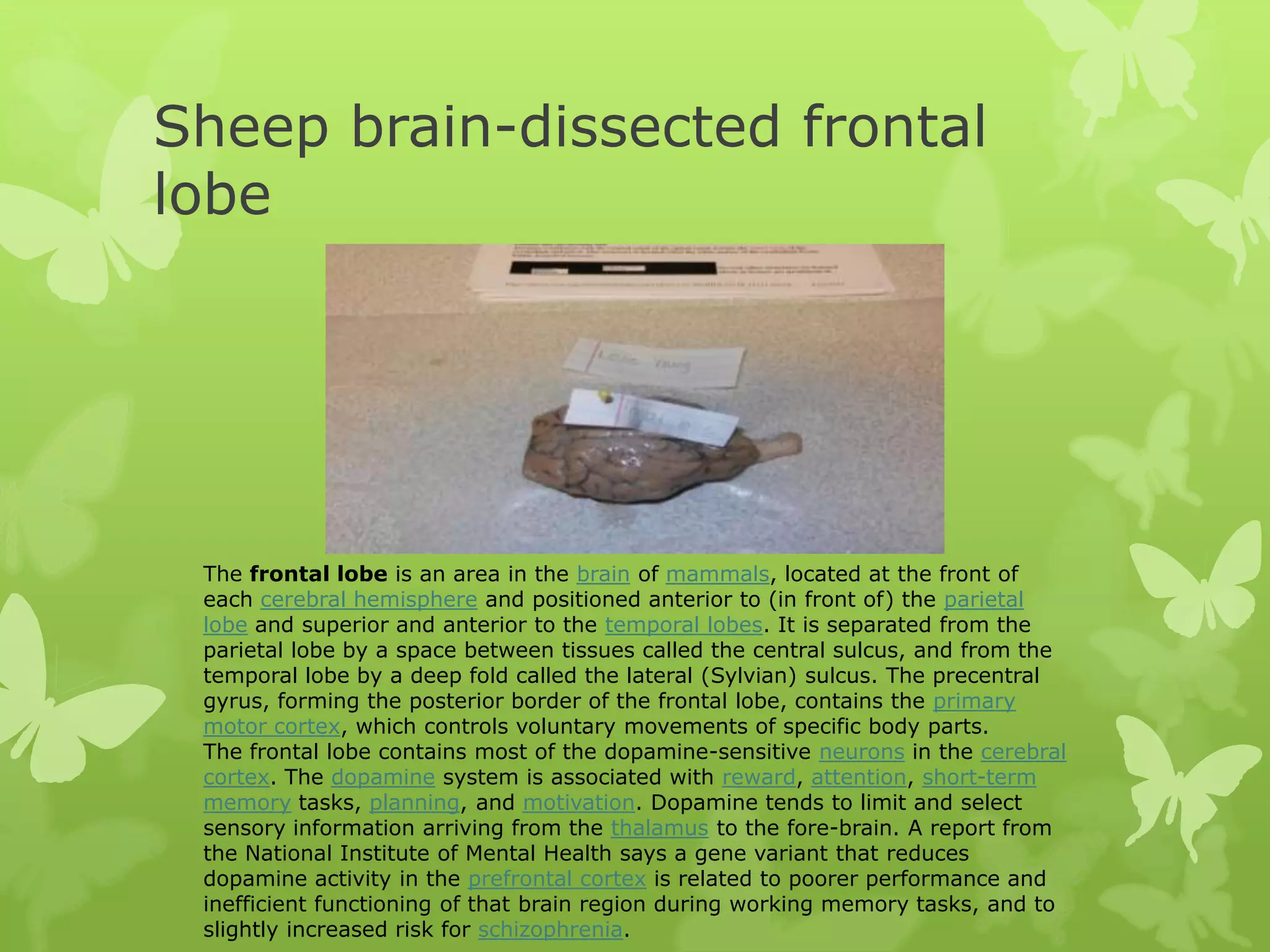 Sheep brain dissection and label | PPTX