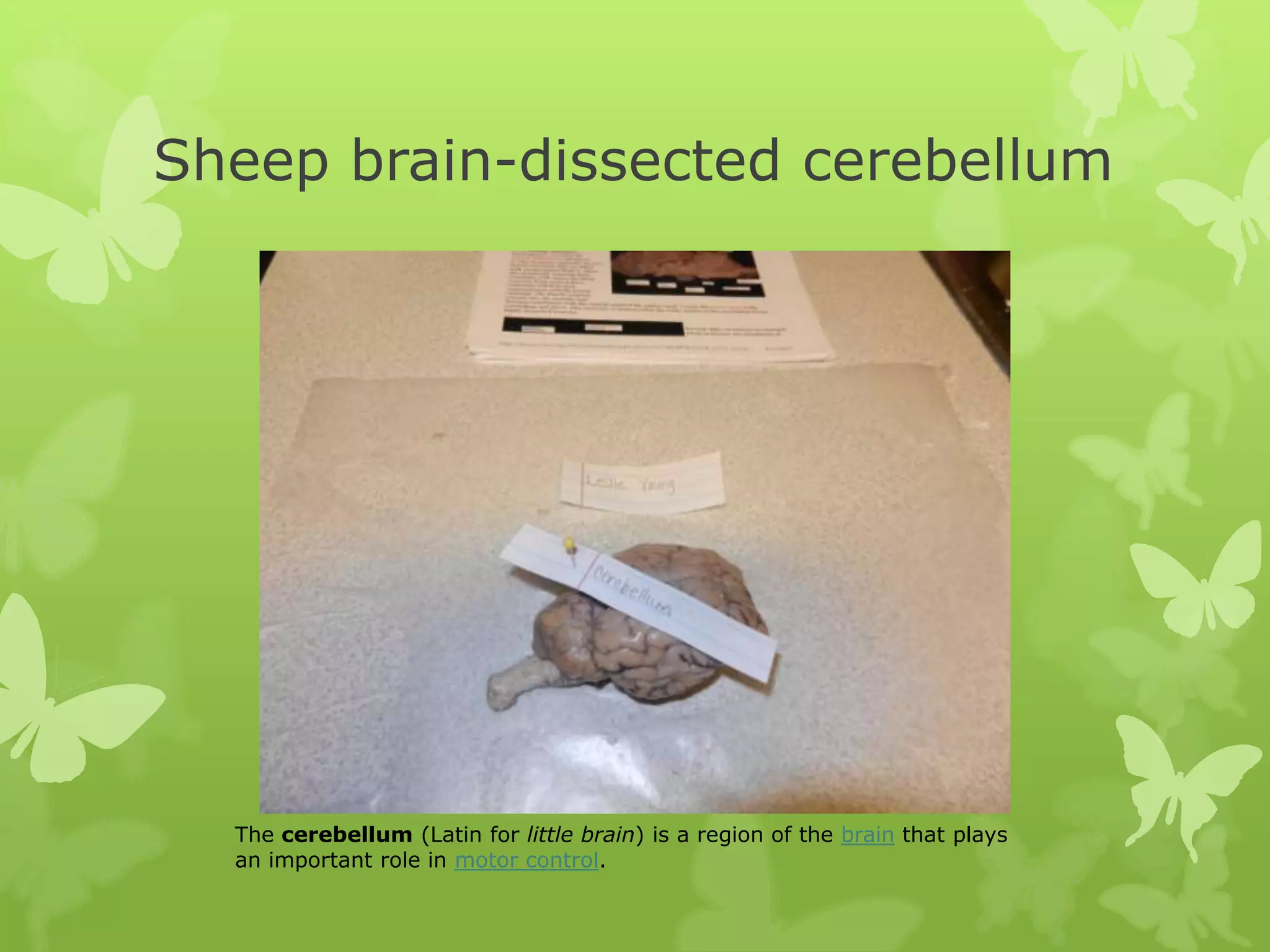 Sheep brain dissection and label | PPTX