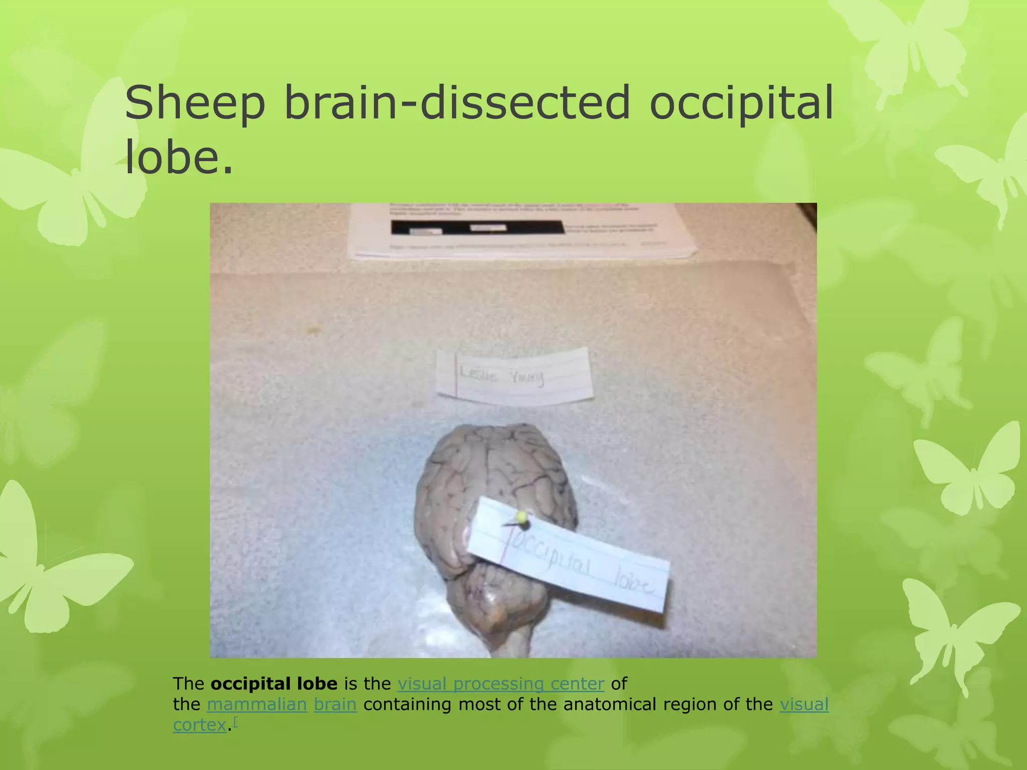 Sheep brain dissection and label | PPTX