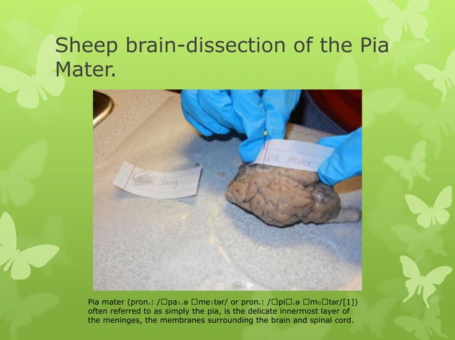 Sheep brain dissection and label | PPTX