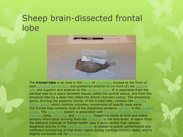 Sheep brain dissection and label | PPTX
