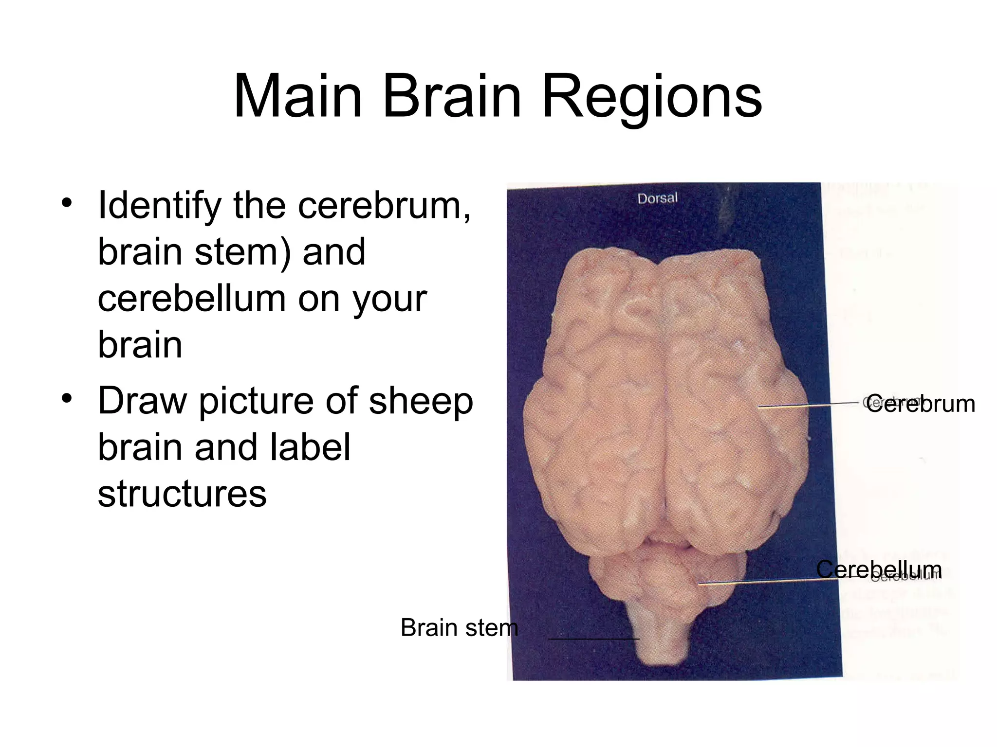 Sheep+brain+dissection | PPT