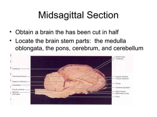 Medulla Oblongata Sheep Brain