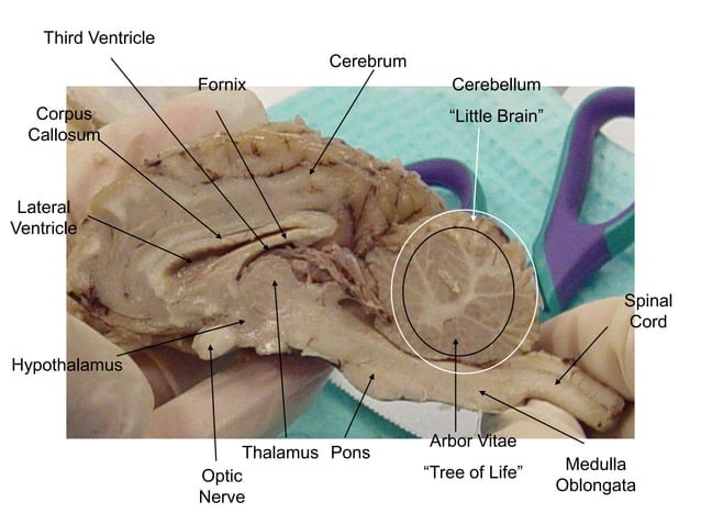 Sheep brain gross anatomy | PDF | Brain and Nervous System Disorders ...
