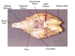 Medulla Oblongata Sheep Brain