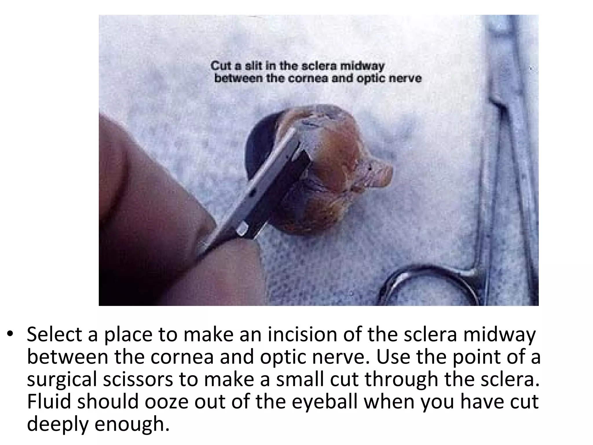 Sheep eye dissection | PPT