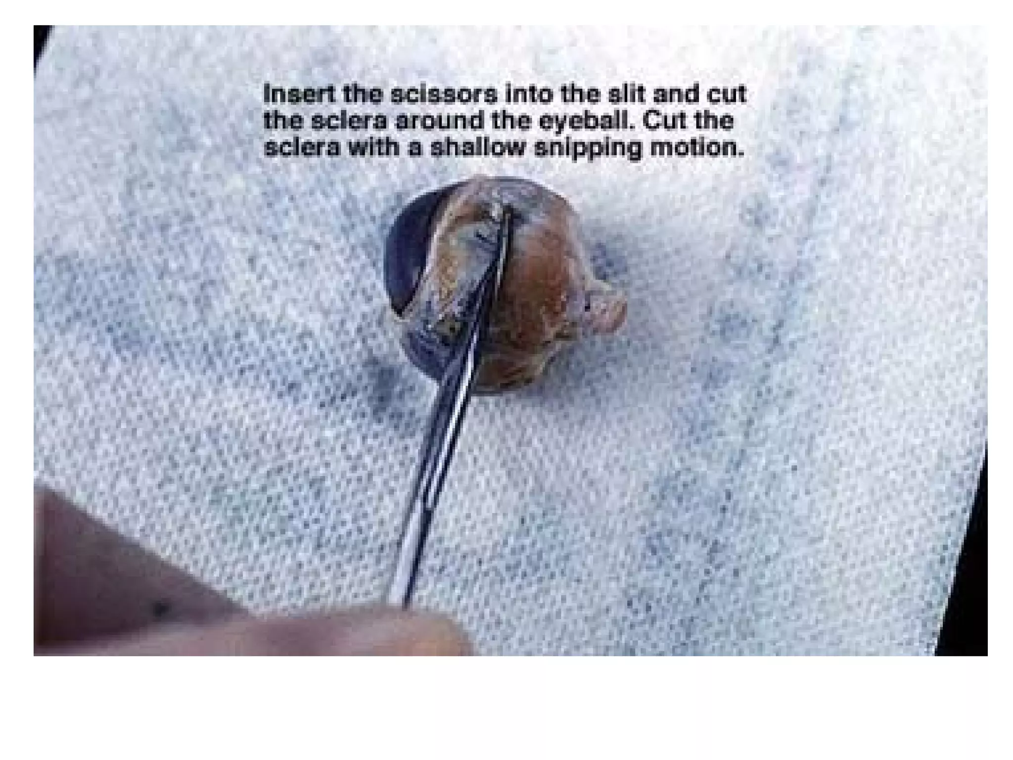 Sheep eye dissection | PPT