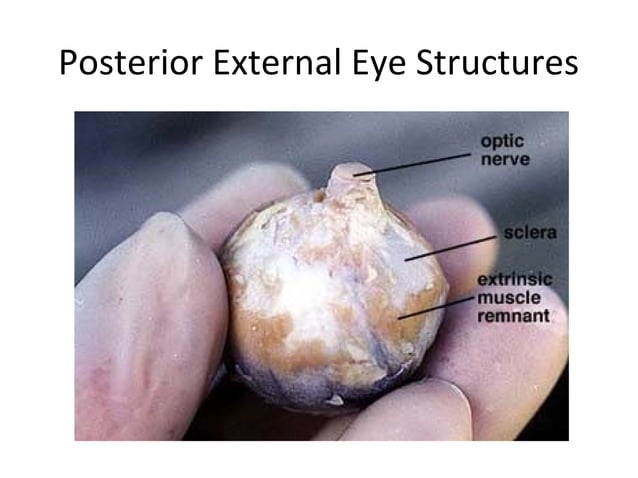 Sheep eye dissection | PPT | Eye and Vision Conditions | Diseases and ...