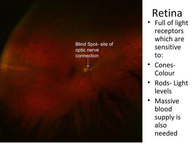Sheep eye dissection | PPT | Eye and Vision Conditions | Diseases and ...