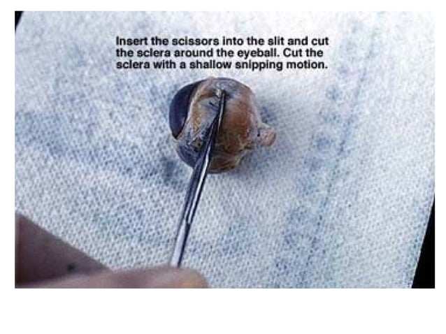 Sheep eye dissection