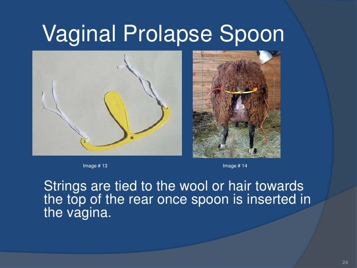 Sheep Prolapse Retainer
