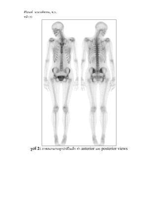 Sheet bone scan | PDF