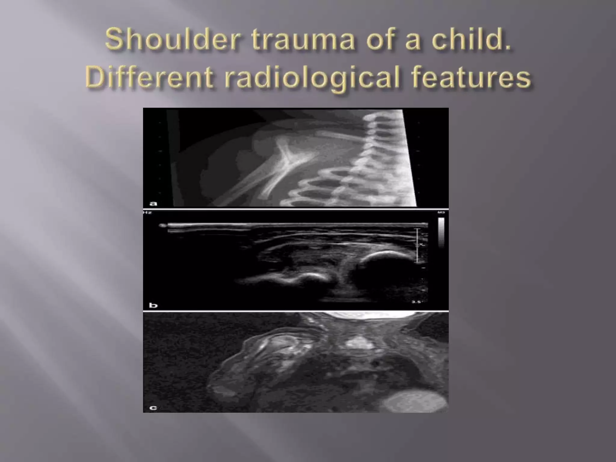 DEVELOPMENT OF THE OSTEOARTICULAR SYSTEM IN CHILDHOOD | PPTX