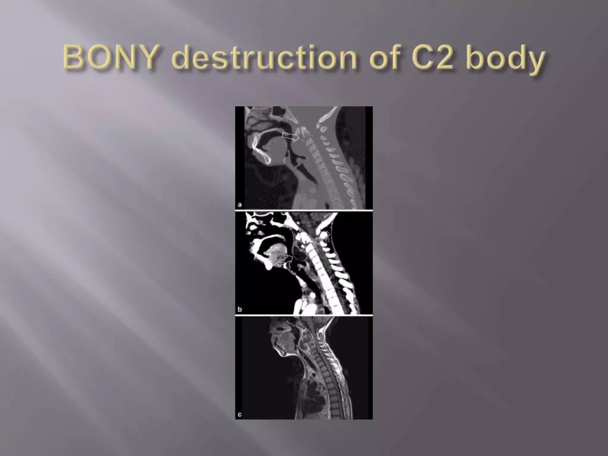 DEVELOPMENT OF THE OSTEOARTICULAR SYSTEM IN CHILDHOOD | PPTX