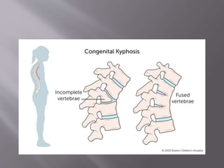 DEVELOPMENT OF THE OSTEOARTICULAR SYSTEM IN CHILDHOOD | PPTX
