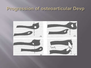 DEVELOPMENT OF THE OSTEOARTICULAR SYSTEM IN CHILDHOOD | PPTX