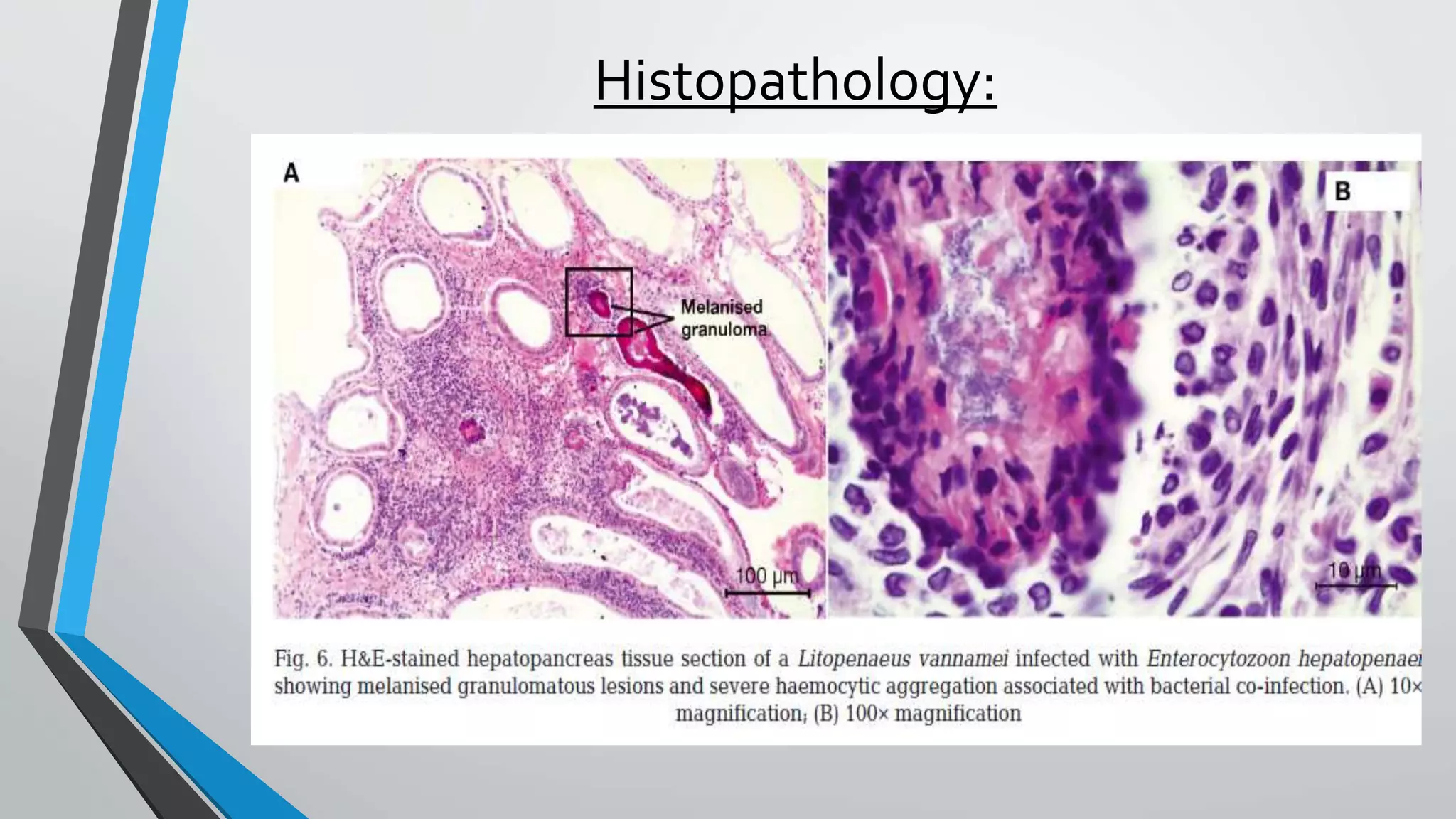 Shell fish parasitic disease | PPTX