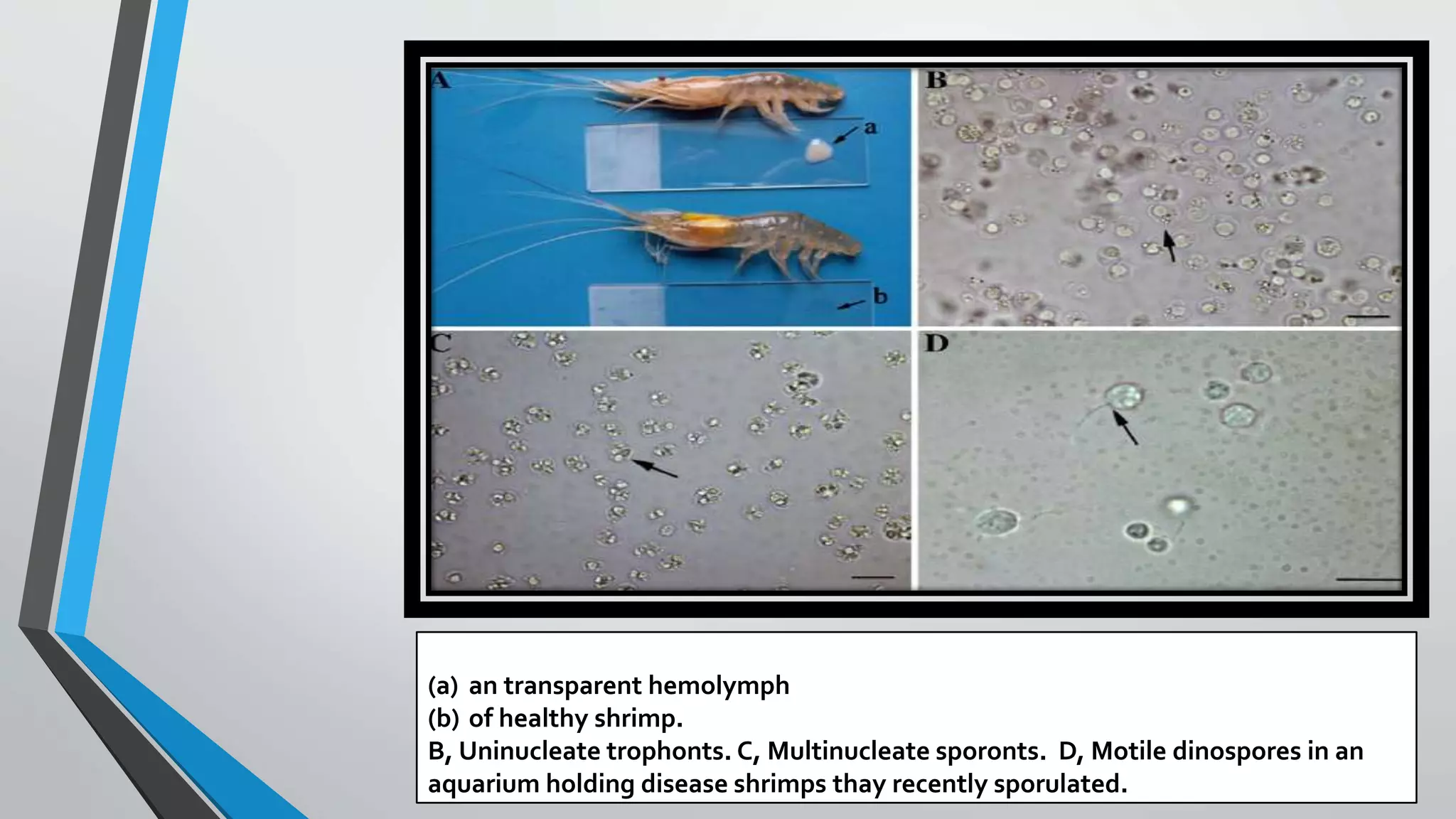 Shell fish parasitic disease | PPTX
