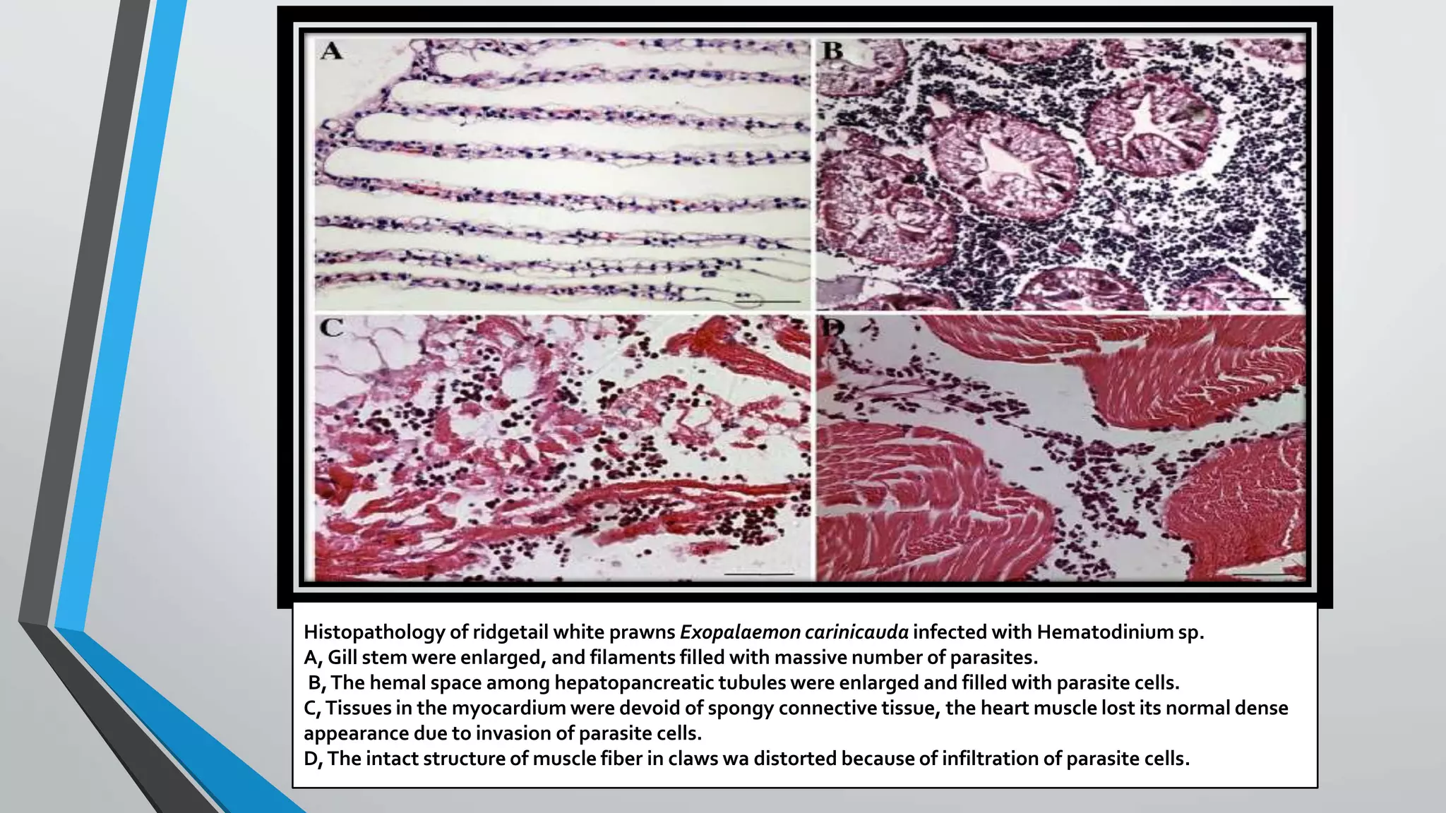Shell fish parasitic disease | PPTX