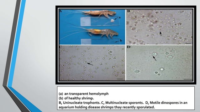 Shell fish parasitic disease | PPTX