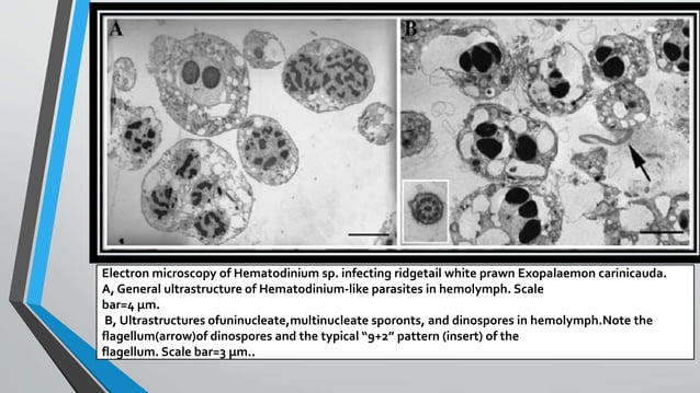 Shell fish parasitic disease | PPTX